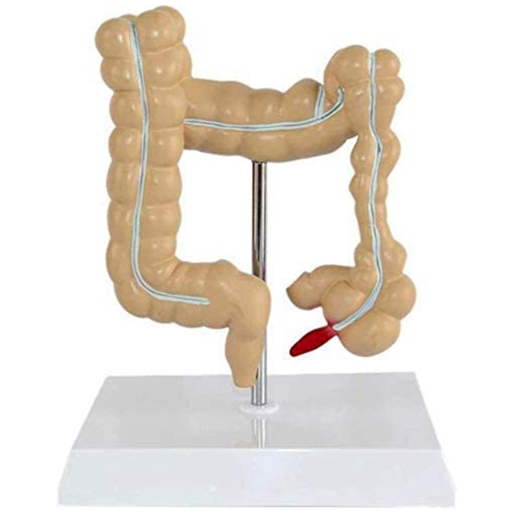 Jual Colon Pathological Colorectal Cancer Model Large Intestine Model ...