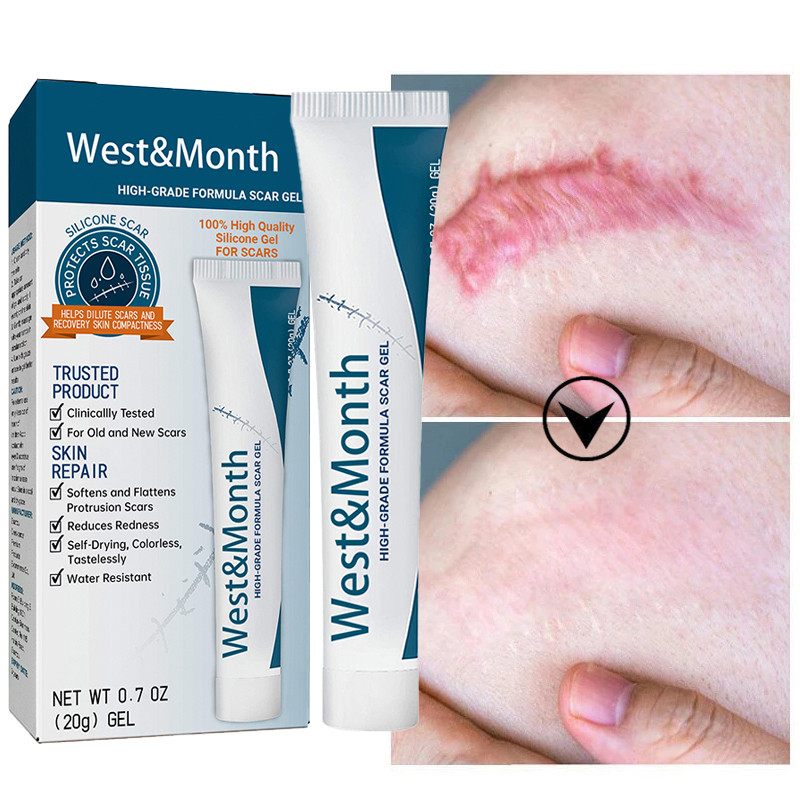 Jual IMPORT Herbal Scar Removal Cream Gel Repaire Pock Mark Burn ...
