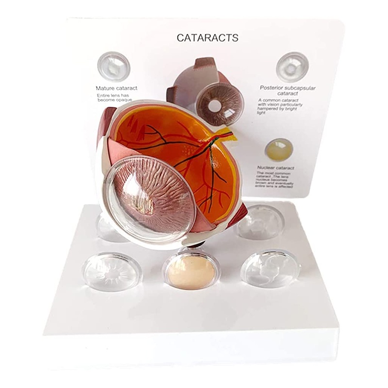 Jual NEW Cornea Eyeball Model Human Eye Model Human Eye Demonstration ...