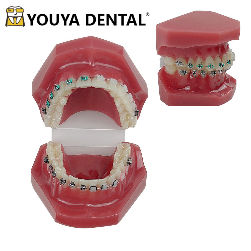 Jual Orthodontic Model Tooth Model for Dentist Student Studying ...