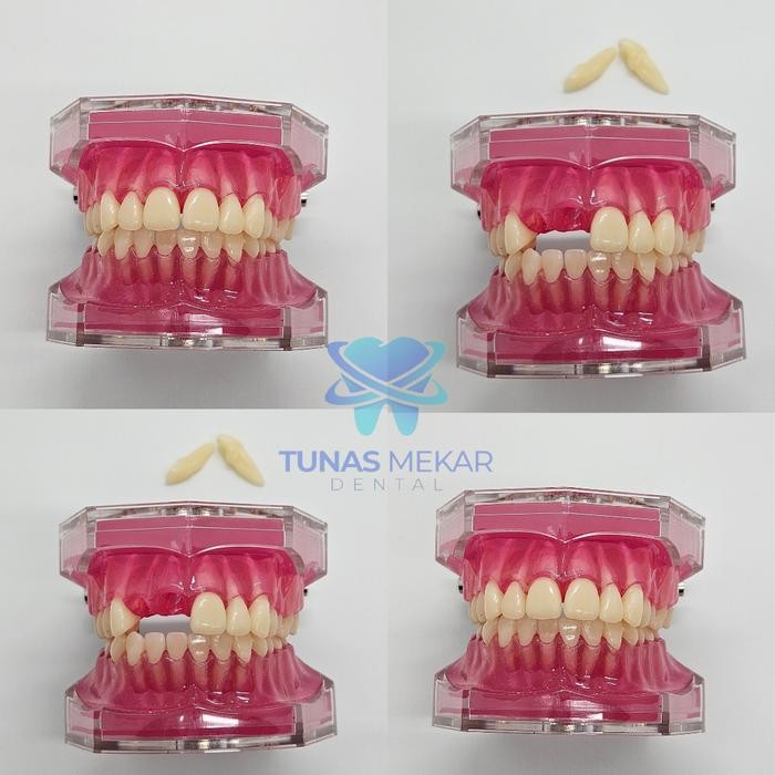 Jual Dental Model Study Gigi Lepasan Phantom Pantum Gigi Rubber ...