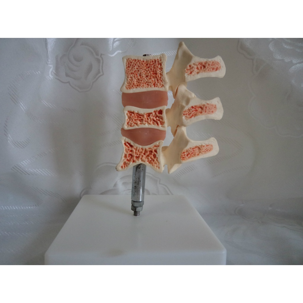 Jual NEW Human anatomical spine Bone vegetable pine model Spinal ...