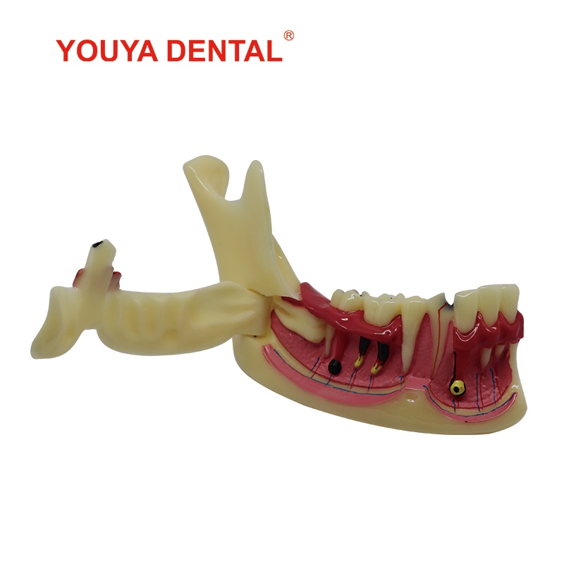 Jual New Dental Endodontic Treatment Model Right Side Mandible Tissue ...