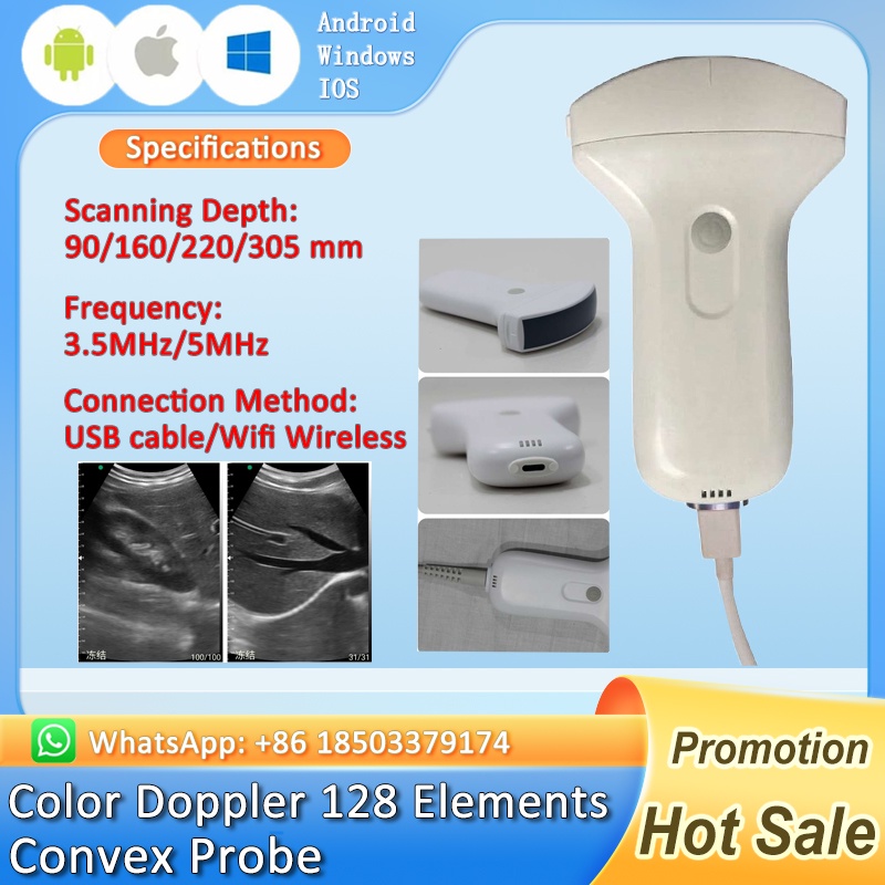 Jual SFC 128Elements 3.5/5MHz Convex Color Portable Wireless Ultrasound ...