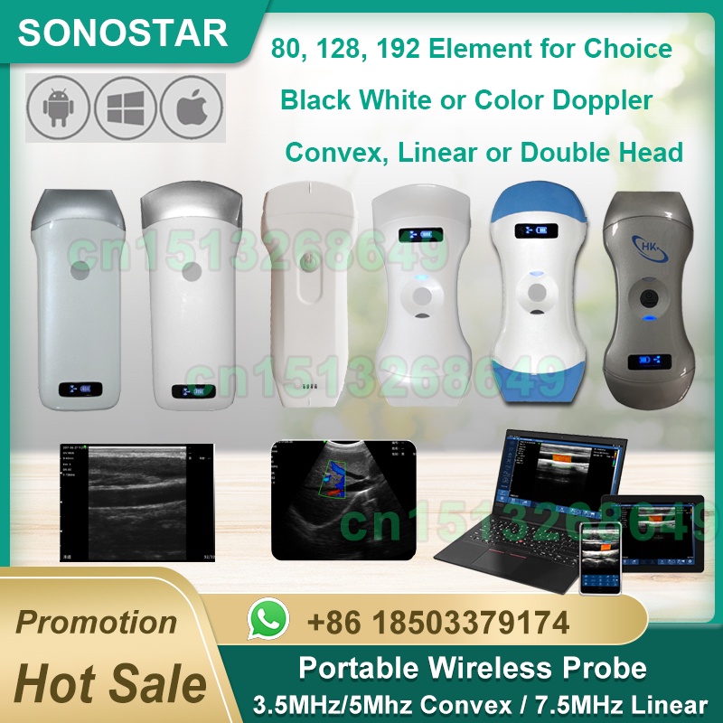 Jual SFC wireless ultrasound probe Portable Wifi Probe Convex / Linear ...