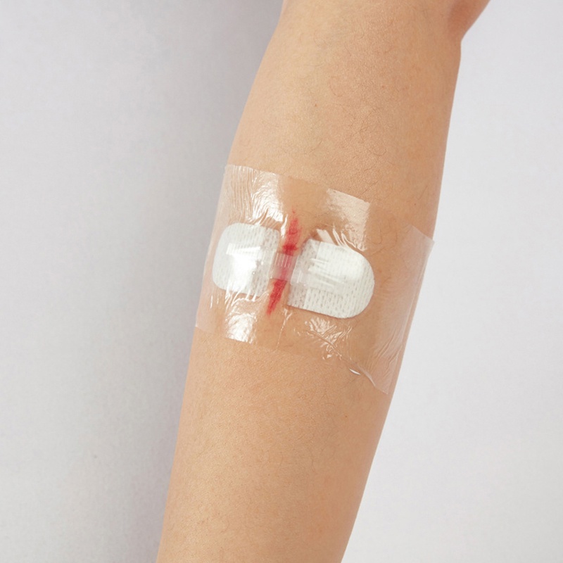 Jual Stitch Free Adhesive Tape For Medical Wound Closure Strips ...