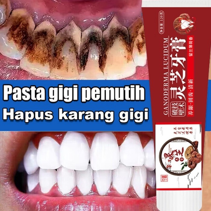Jual Ori 100% Ganoderma Ampuh Pasta Gigi Berlubang Penumbuh Gigi Odol ...