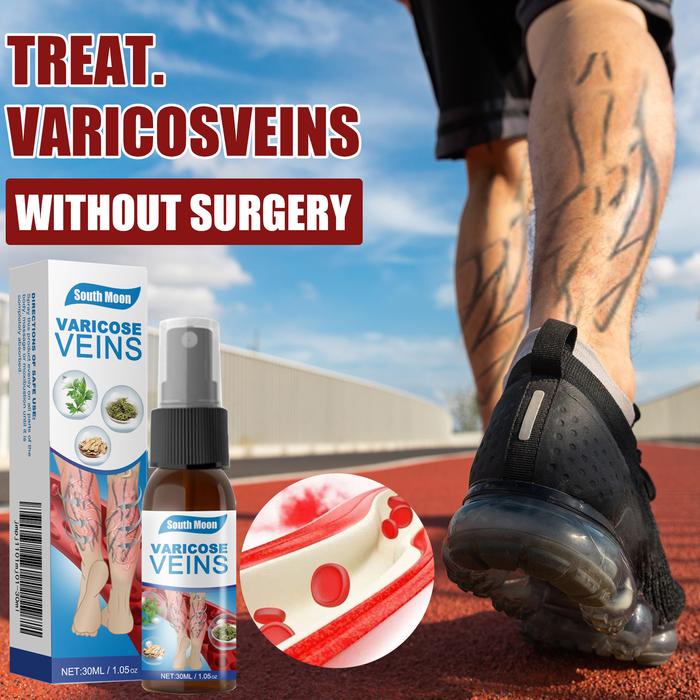Jual Varicose Veins Spray Obat Varises p Penghilang Varises Vaskulitis ...