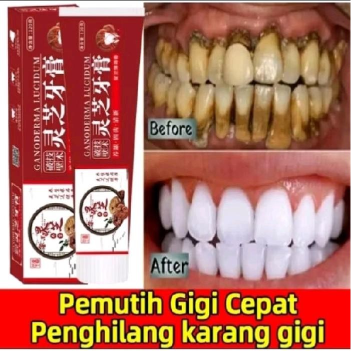 Jual Ganoderma Lucidum Pasta Gigi Ori Penguat Gigi Goyang Perontok ...