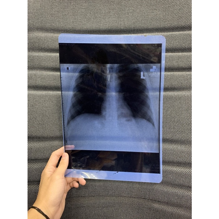 Jual Kertas Print Ronsen Rontgen Blue Film A4 X Ray Xray Film | Shopee ...