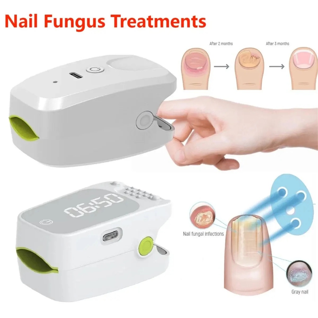 Jual New 905NM Nail Fungus Treatment Tools Fungal Laser Nail Therapy ...