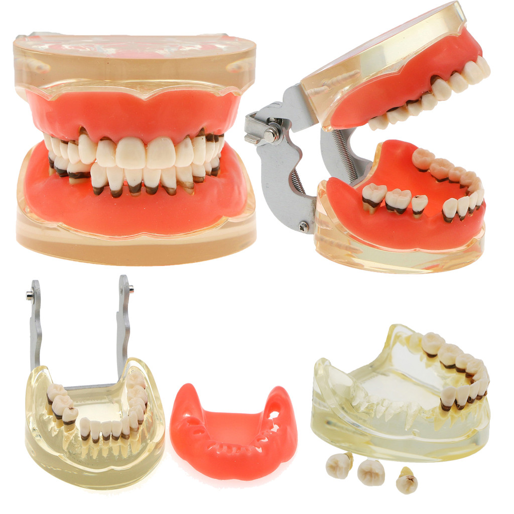 Jual NEW Dental Teeth Model Dentist Teaching Model Demonstration ...