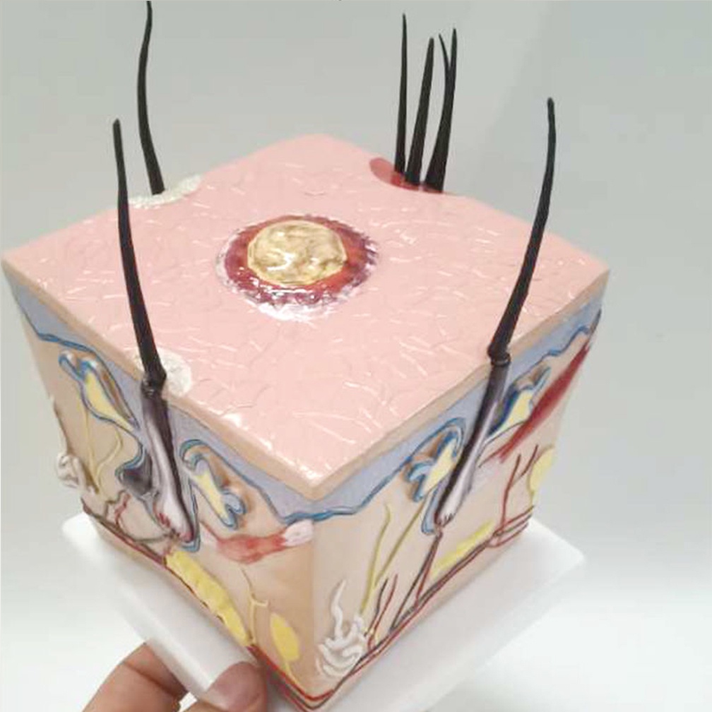 Jual New Human Scalp Model Hair Loss Transplant Follicle Inflammation ...