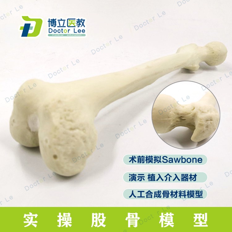 Jual New Artificial Femur Model Orthopedic Pfna Operation Sawbone ...