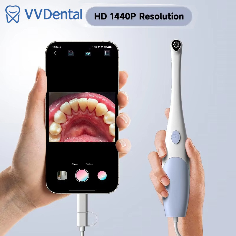 Jual 2 In1 Ios And Type C 1440P Dental Intra Oral Camera Handy Portable ...