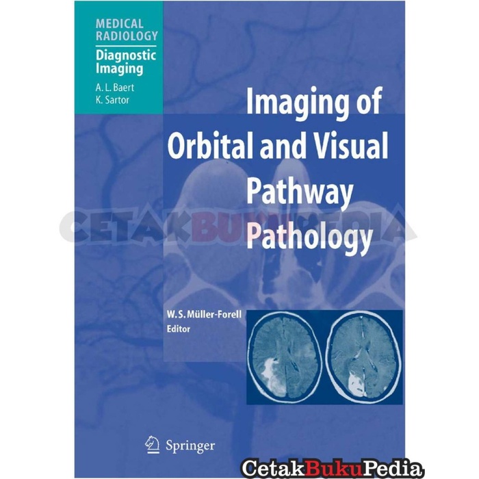 Jual book Imaging Of Orbital Visual Pathway Pathology Medical Radiolog ...