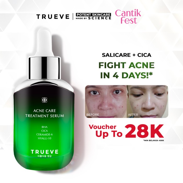 Jual ACBEAUTY- TRUEVE Acne Care Treatment Serum 30 ML -yuk c.o | Shopee ...