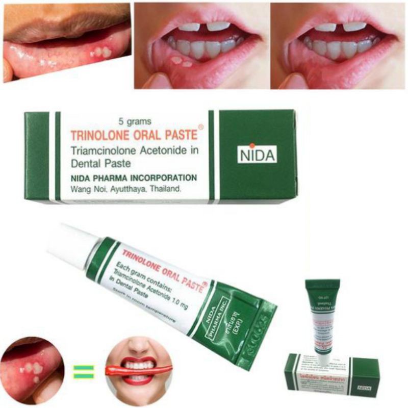 Jual Original trinolone gengigel oral aid aloclair gel obat sariawan ...