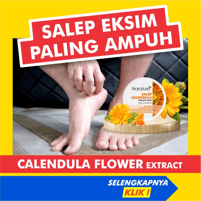 Jual Narature Calendula Salve Salep Obat Gatal Eksim Kering Menahun ...