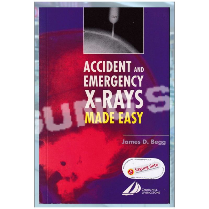 Jual Accident And Emergency X-Rays Made Easy - James | Shopee Indonesia