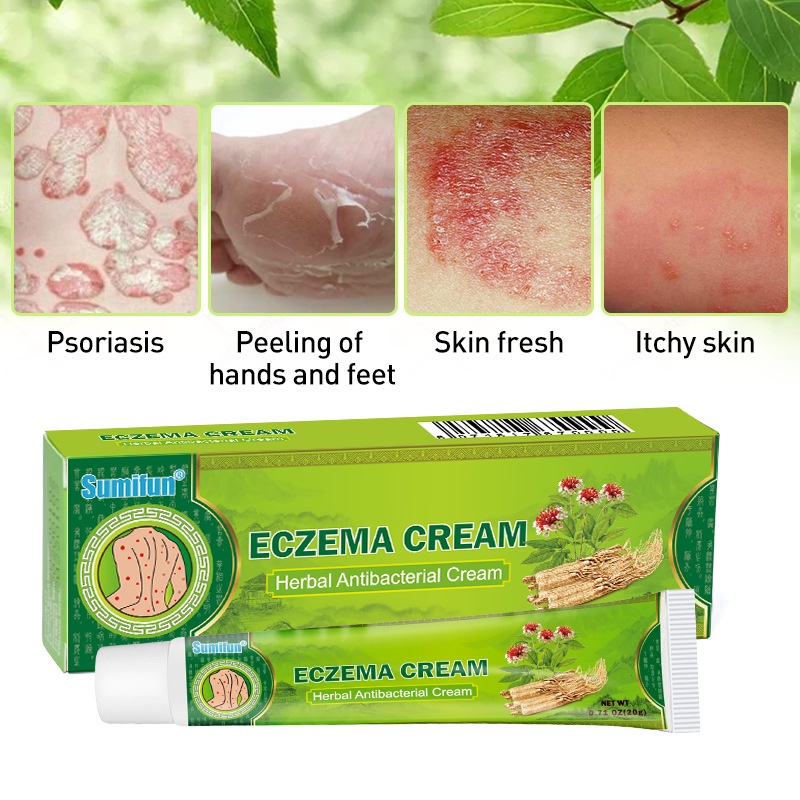 Jual Sumifun Eczema Cream Rim Anti Gatal Salep Kulit Eksim Dermatitis ...