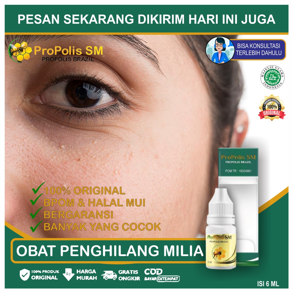 Jual Obat Milia Penghilang Milia Benjolan Putih di Dagu Pipi Hidung ...