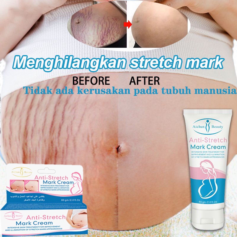 Jual StretchMark Cream Pregnancy Cream Krim Stretch Mark 60g by Mama’s ...