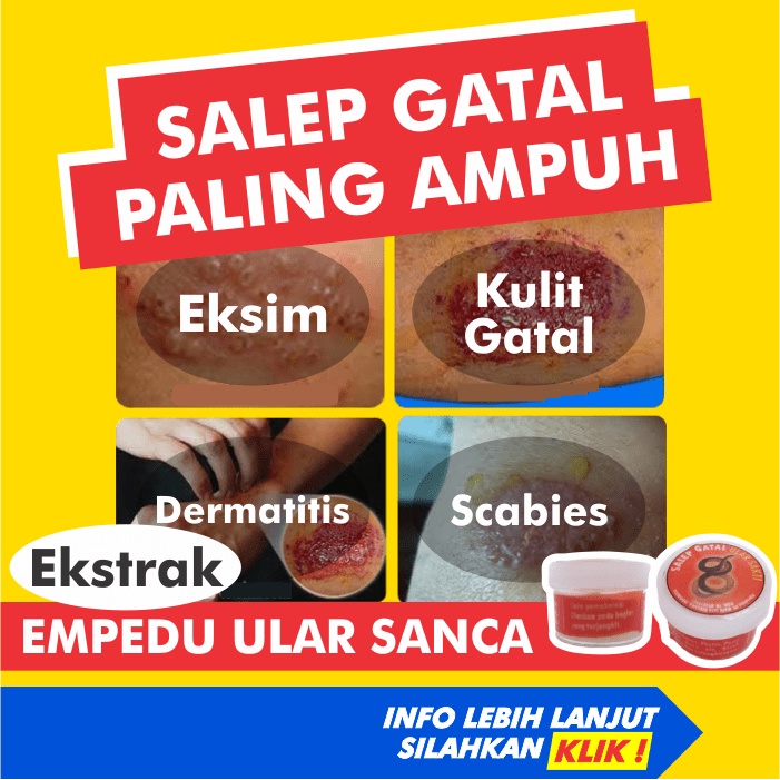 Jual Salep Gatal Paling Ampuh Obat Gatel Saleb Selangkangan Eksim ...