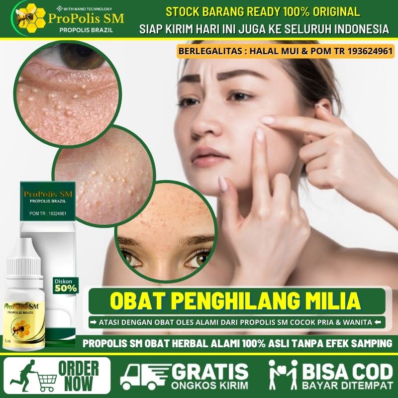 Jual BISA COD - Obat MILIA 100% ORI, Obat Oles Bruntusan di Kelopak ...