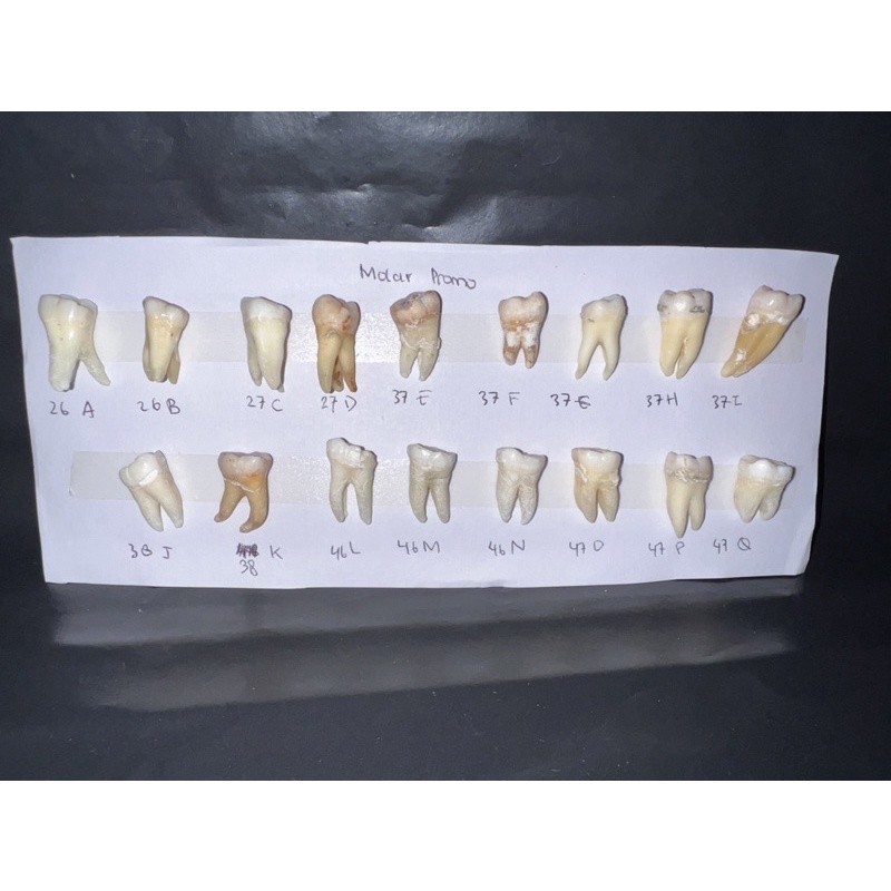 Jual promo gigi molar rahang bawah | Shopee Indonesia