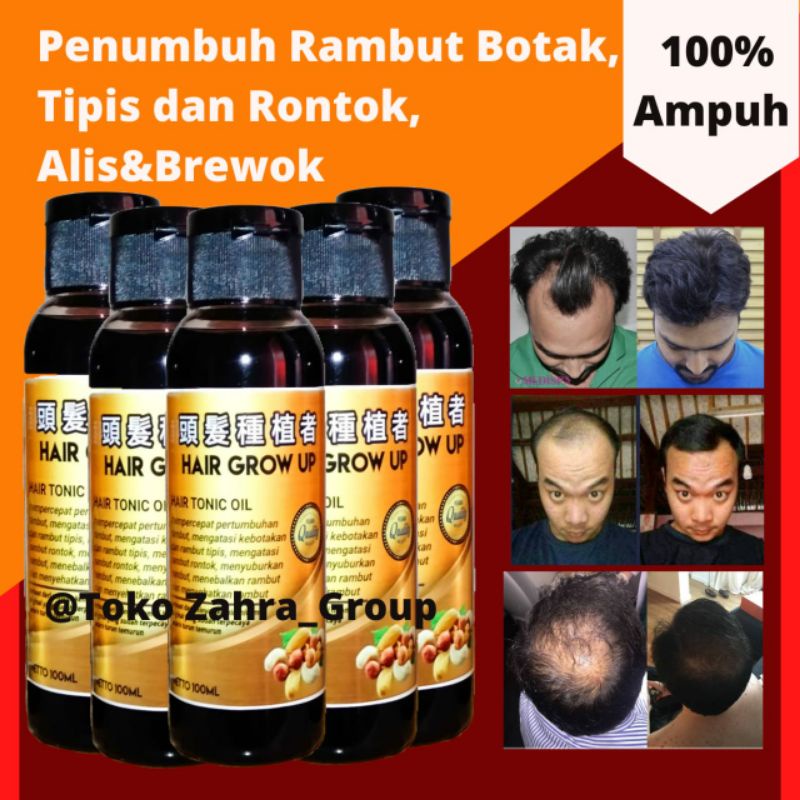 Jual Paket 3 Botol Hair Grow Up Obat Penumbuh Rambut Botak dan Rontok ...