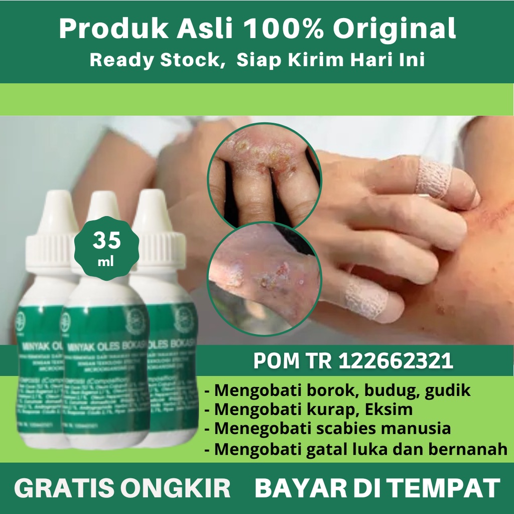 Jual Obat Borok, Budug, Buduk, Kulit Gatal Cenang Bernanah - Efektif ...