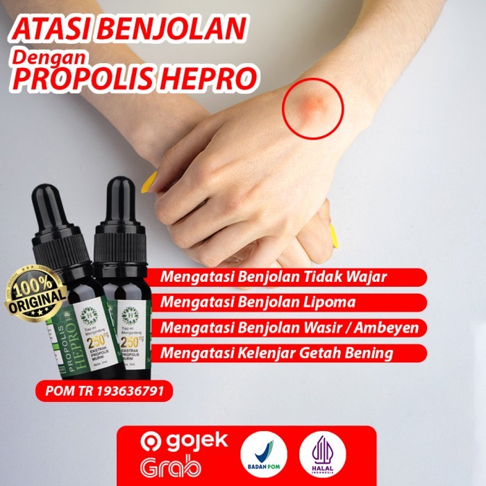 Jual Propolis Hepro Mengatasi Lipoma 10 ml | Shopee Indonesia