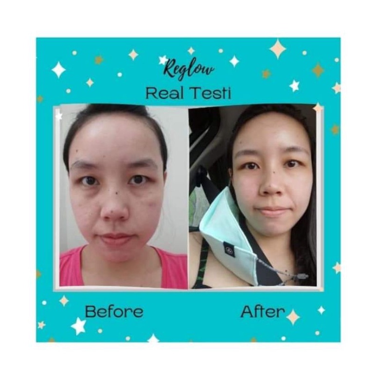 Jual reglow skincare dr. shindy putri (KK ria ricis) | Shopee Indonesia