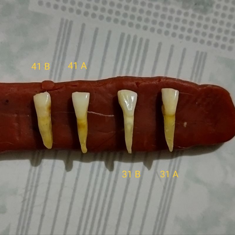 Jual Gigi Insisivus Bawah / Gigi Insisif Bawah / Gigi 31 / Gigi 41 ...