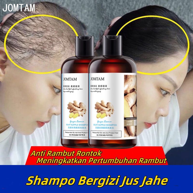 Jual shampo penumbuh rambut cepat Anti rambut rontok Botak ginger shampoo 400ml kontrol minyak ...