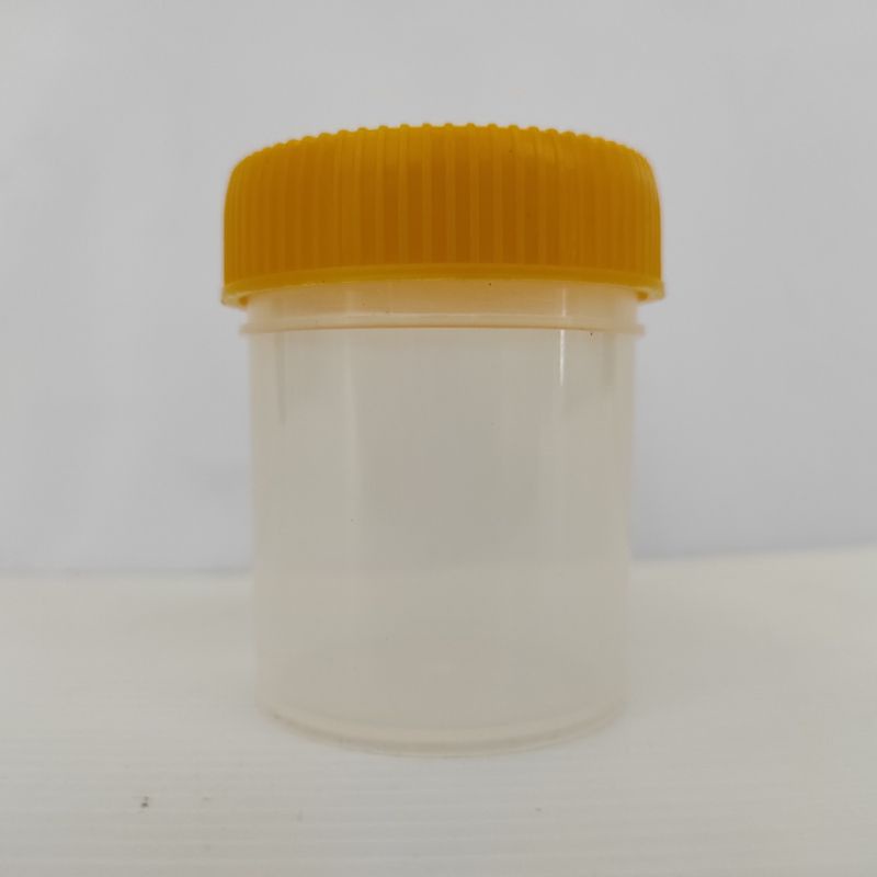 Jual Urine container 60ml/ pot urine 60ml | Shopee Indonesia