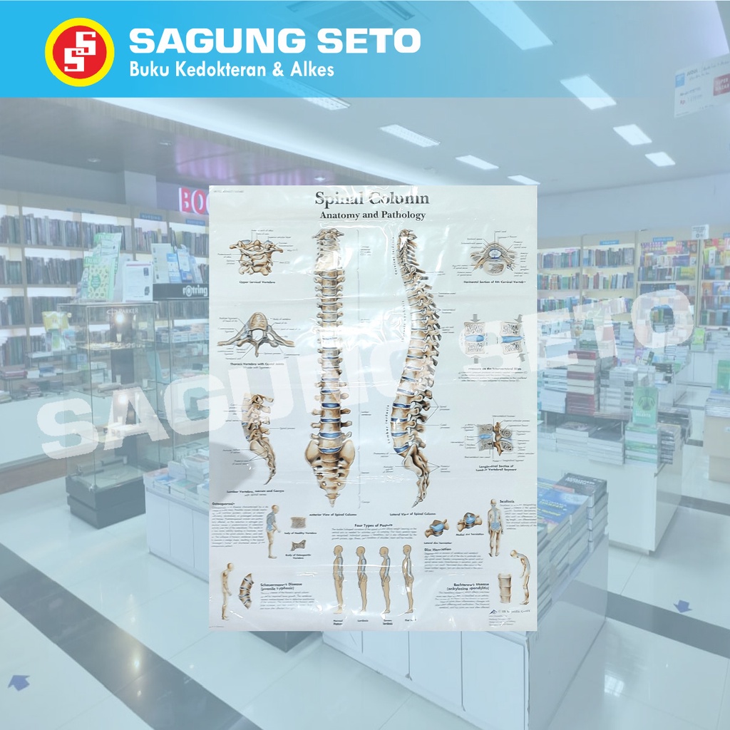 Jual CHART SPINAL COLUMN VR1152UU/POSTER SPINAL COLUMN | Shopee Indonesia