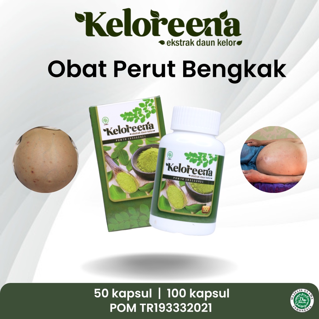 Jual Sapnu Herbal - Obat Asites Perut Bengkak, Perut Membesar, Busung ...