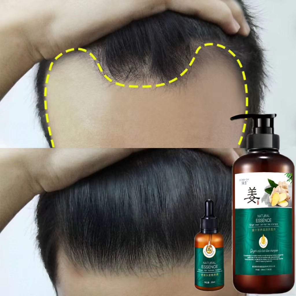 Jual [100% asli] Shampo penumbuh rambut cepat Ginger shampoo botak ...