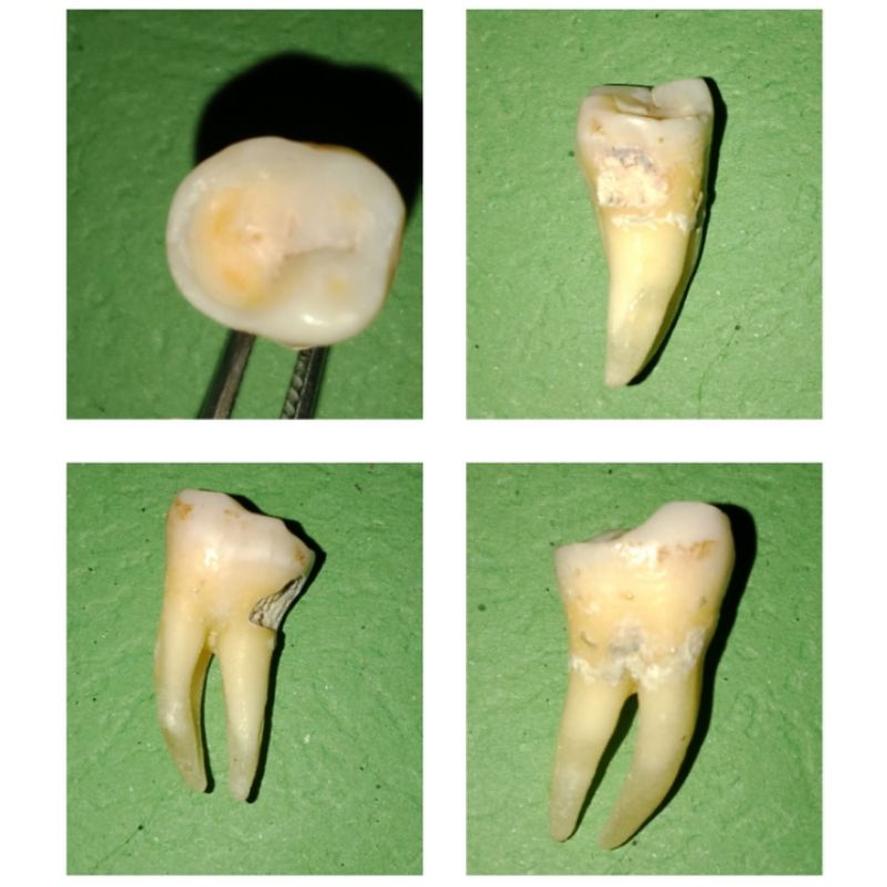Jual *Promo* gigi praktikum murah/gigi asli/gigi molar premolar canine ...