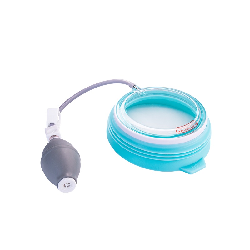 Jual Vacuum Bell Alat Terapi Medis untuk Pectus Excavatum PE Dada ...