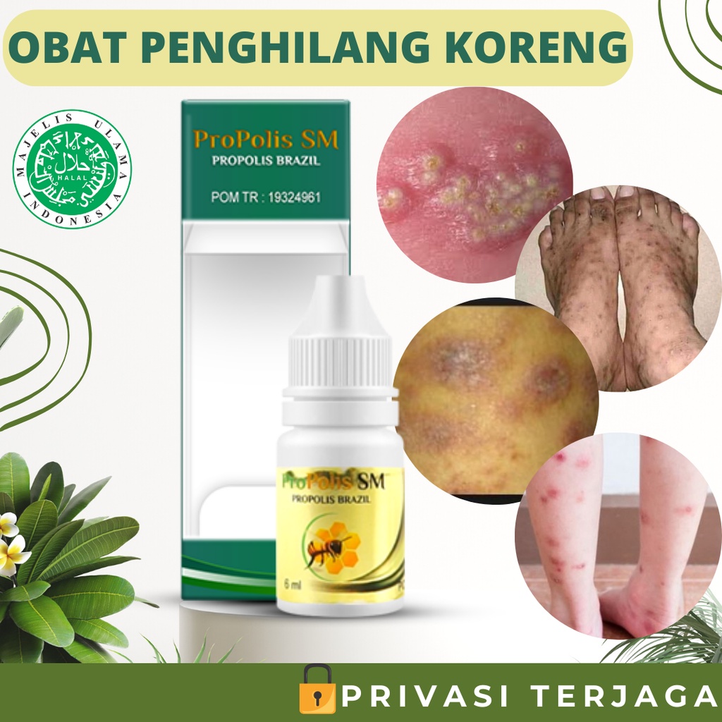 Jual Obat Koreng di kaki, Obat Darah Manis, Amis Daging, Obat ...