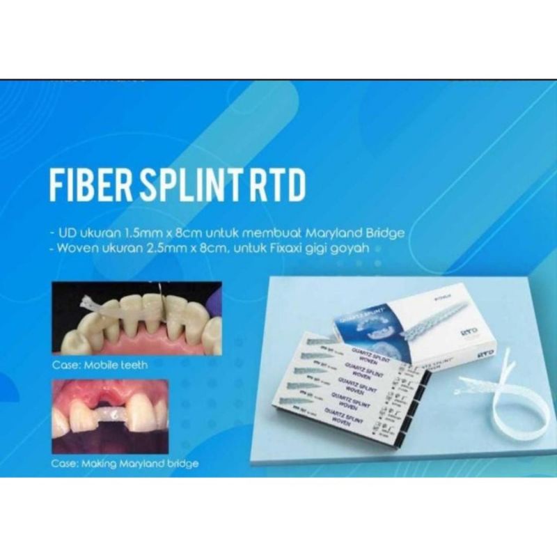 Jual FIBER SPLINT RTD | Shopee Indonesia