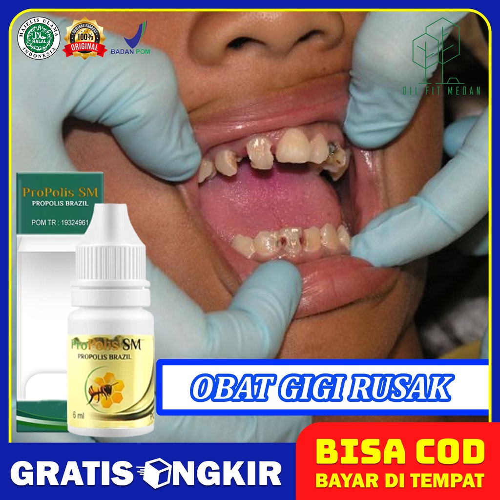 Jual Obat Gusi Bengkak Karena Gigi Berlubang Gigi Cenat Cenut Benjolan Di Lidah Benjolan Di ...
