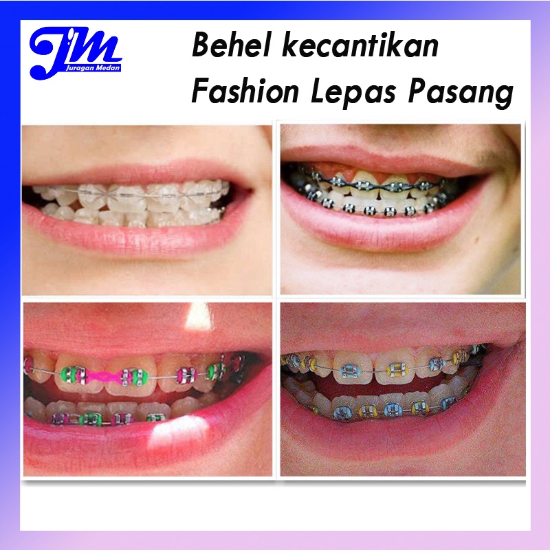Jual [Ready Stock] Behel Fashion Gigi Lepas Pasang Murah Warna AF0183 ...