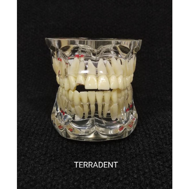 Jual Duradent Model gigi / Dental study phantom gigi dewasa transparan ...