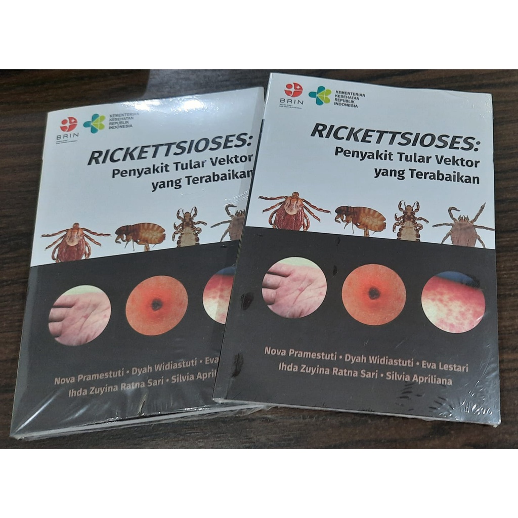 Jual Buku Rickettsioses: Penyakit Tular Vektor yang Terbaikan | Shopee ...