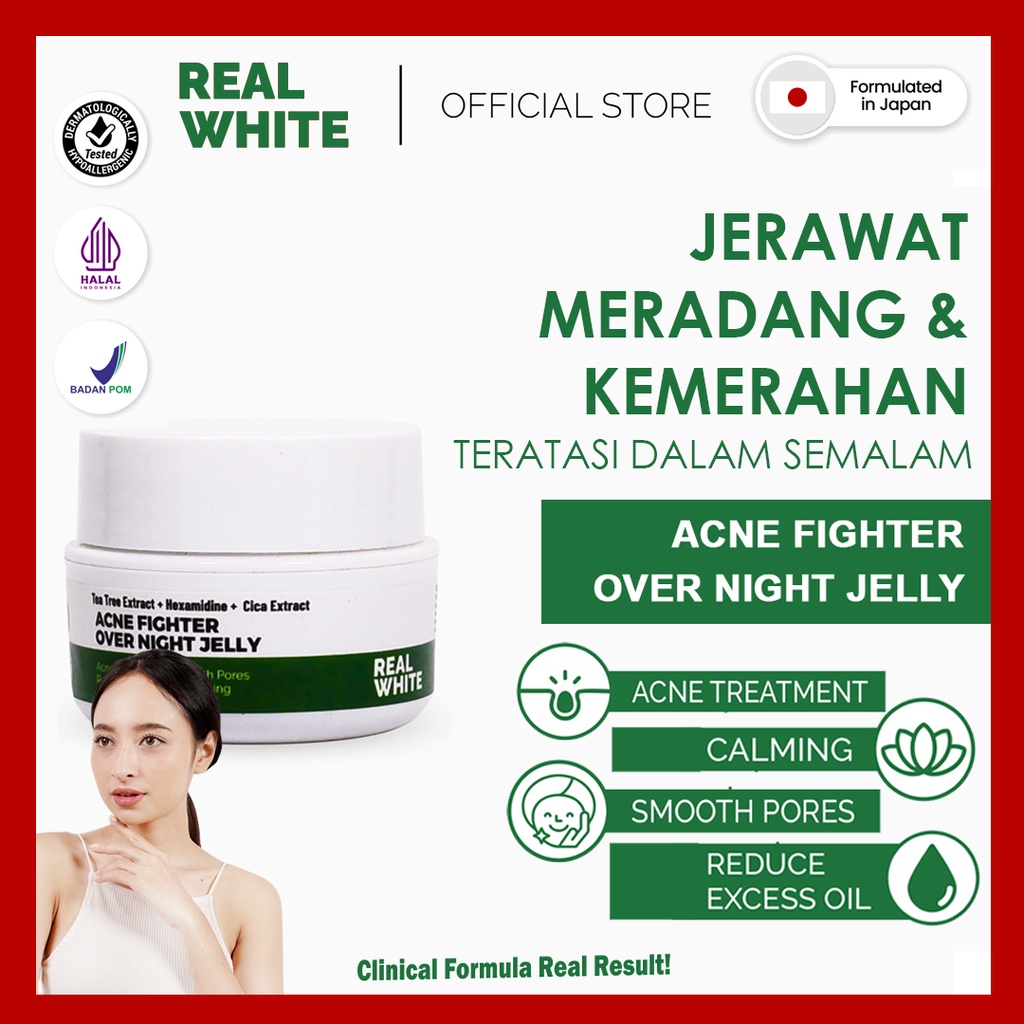 Jual 𝐑𝐄𝐀𝐋 𝐖𝐇𝐈𝐓𝐄 Acne Fighter Over Night Jelly Jerawat Meradang |BPOM ...
