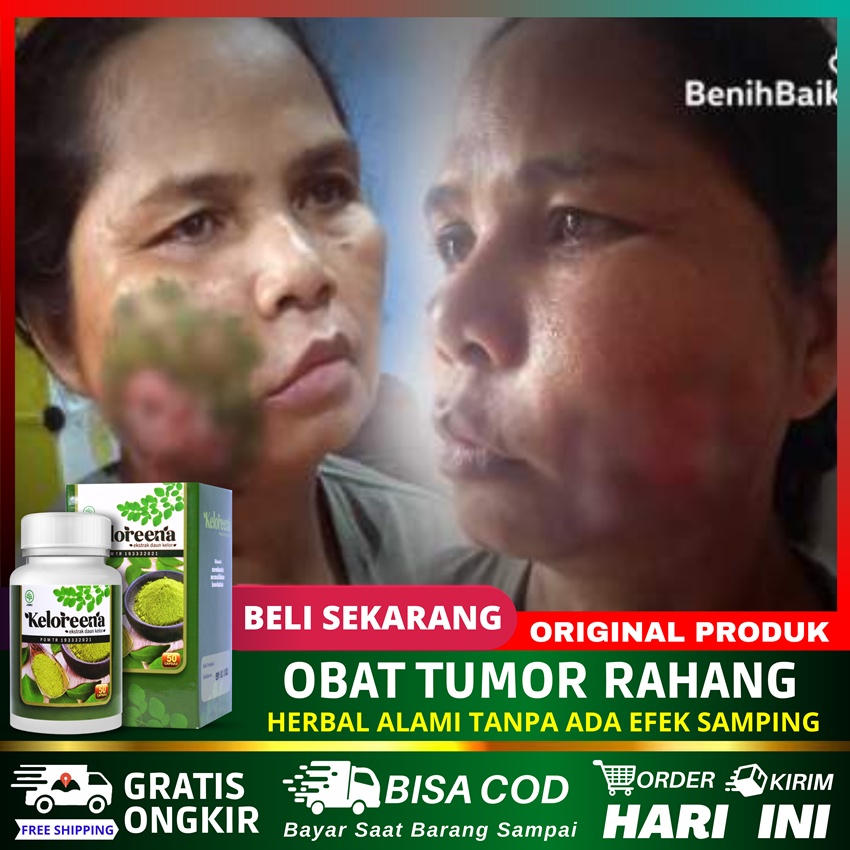 Jual Obat Tumor Rahang Gusi, Kanker Mulut, Suplemen Pengobatan Tumor ...